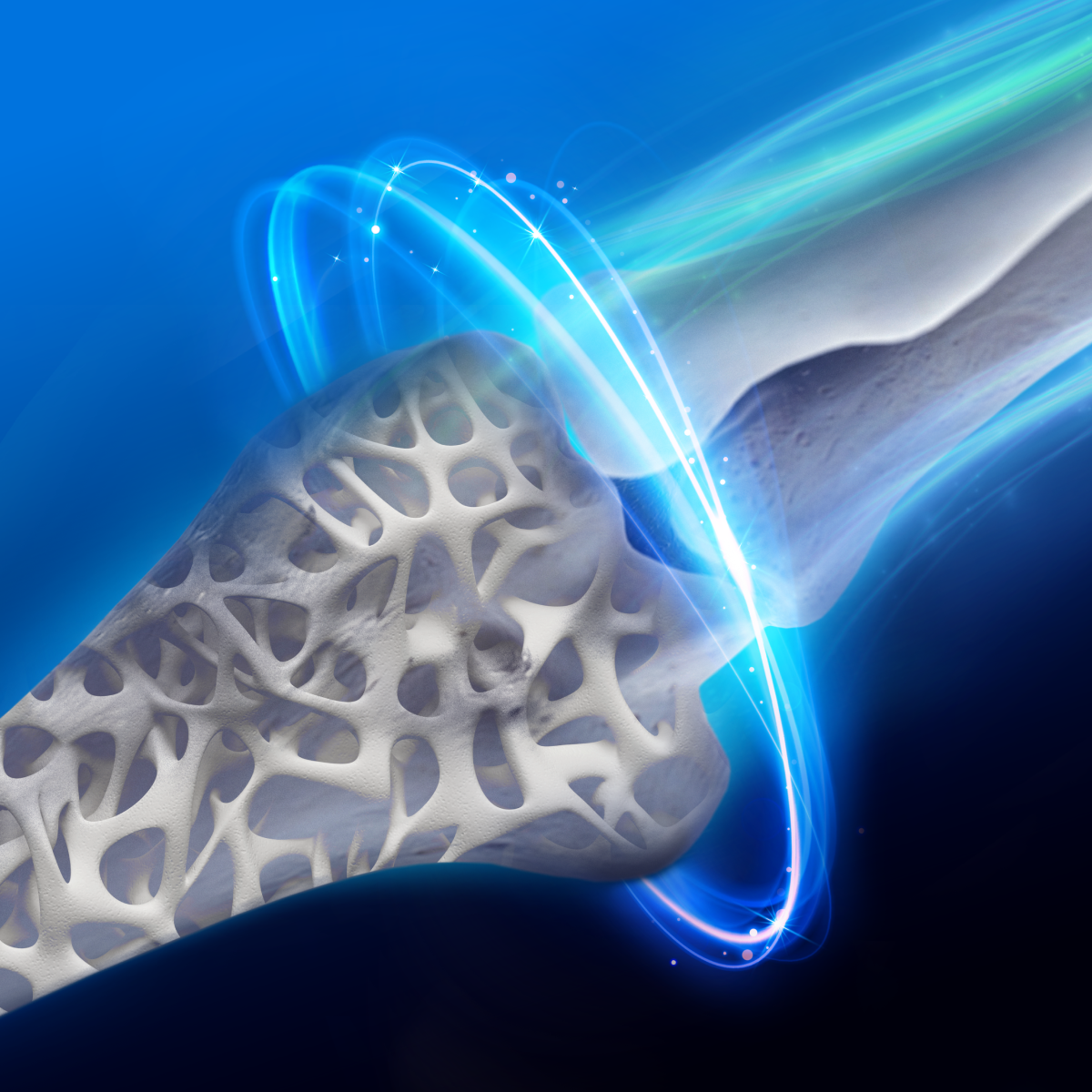 OsteoIQ™ Active Monitoring (CTX & P1NP)