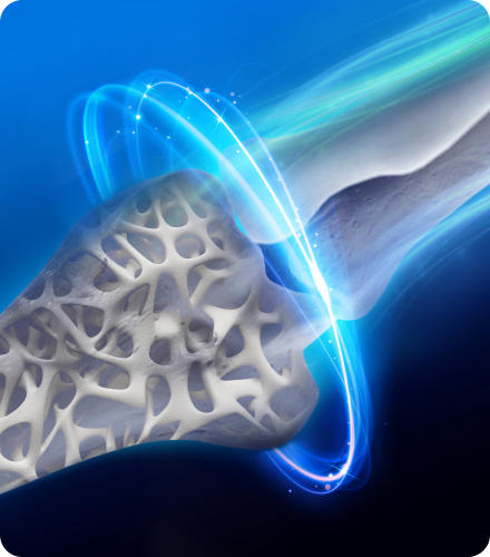 OsteoIQ™ Active Monitoring (CTX & P1NP)